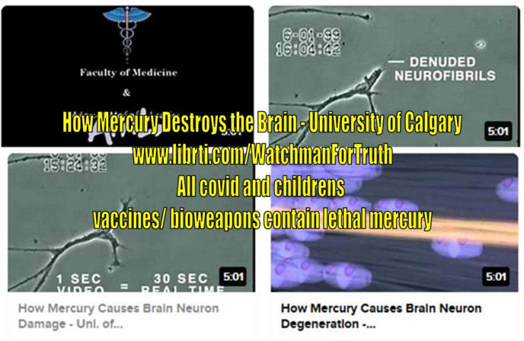 How #Mercury #Destroys the #Brain - The Cause of #AUTISM is #MERCURY- #University of #Calgary ...